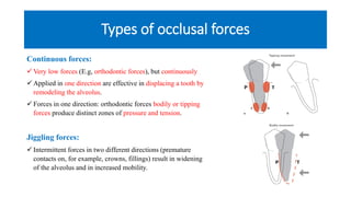 Trauma from Occlusion | PPT
