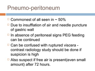 percutaneous endoscopic gastrostomy | PPT