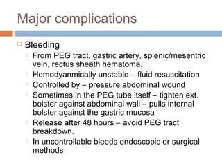 percutaneous endoscopic gastrostomy | PPT