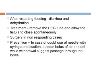 percutaneous endoscopic gastrostomy | PPT