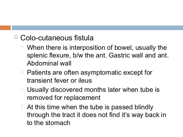 percutaneous endoscopic gastrostomy