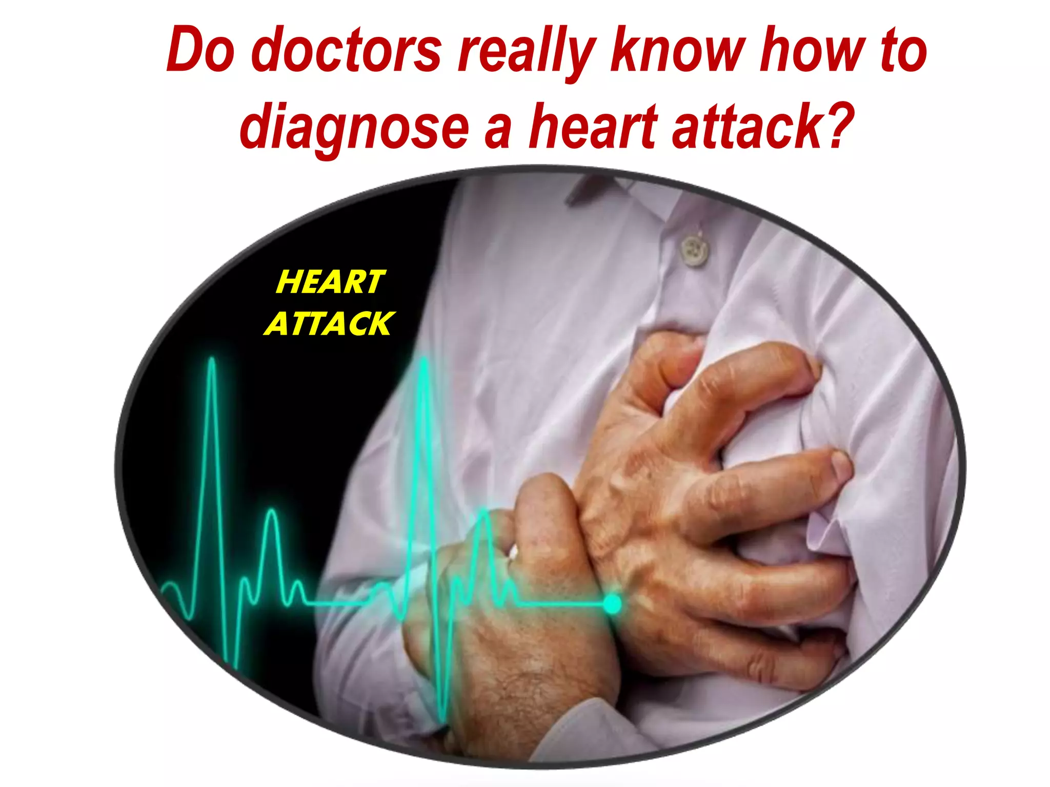 Fourth Universal Definition Of Myocardial Infarction (2018) | PPTX