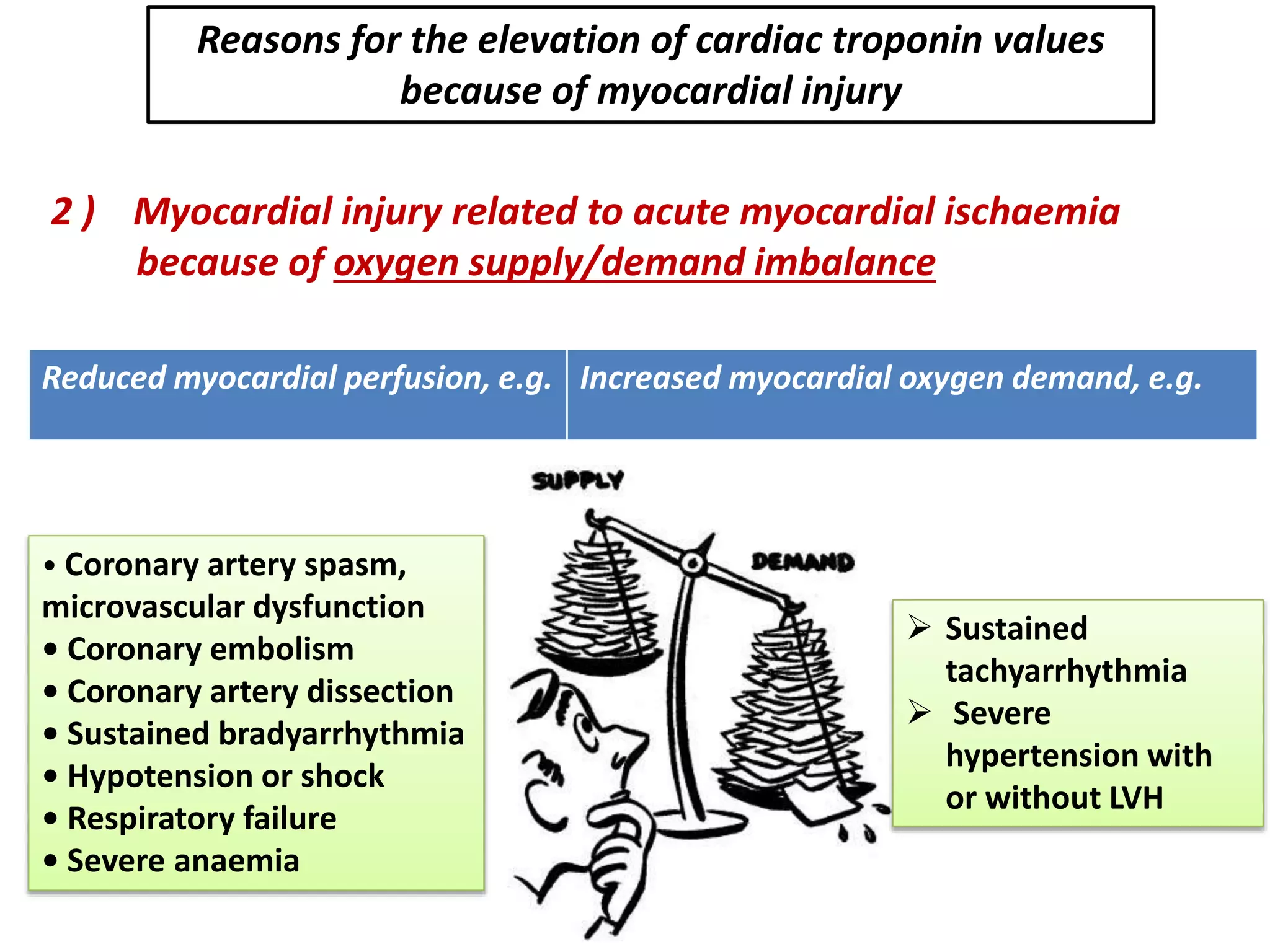 Fourth Universal Definition Of Myocardial Infarction (2018) | PPT Fourth Universal Definition Of Myocardial Infarction (2018) | PPT