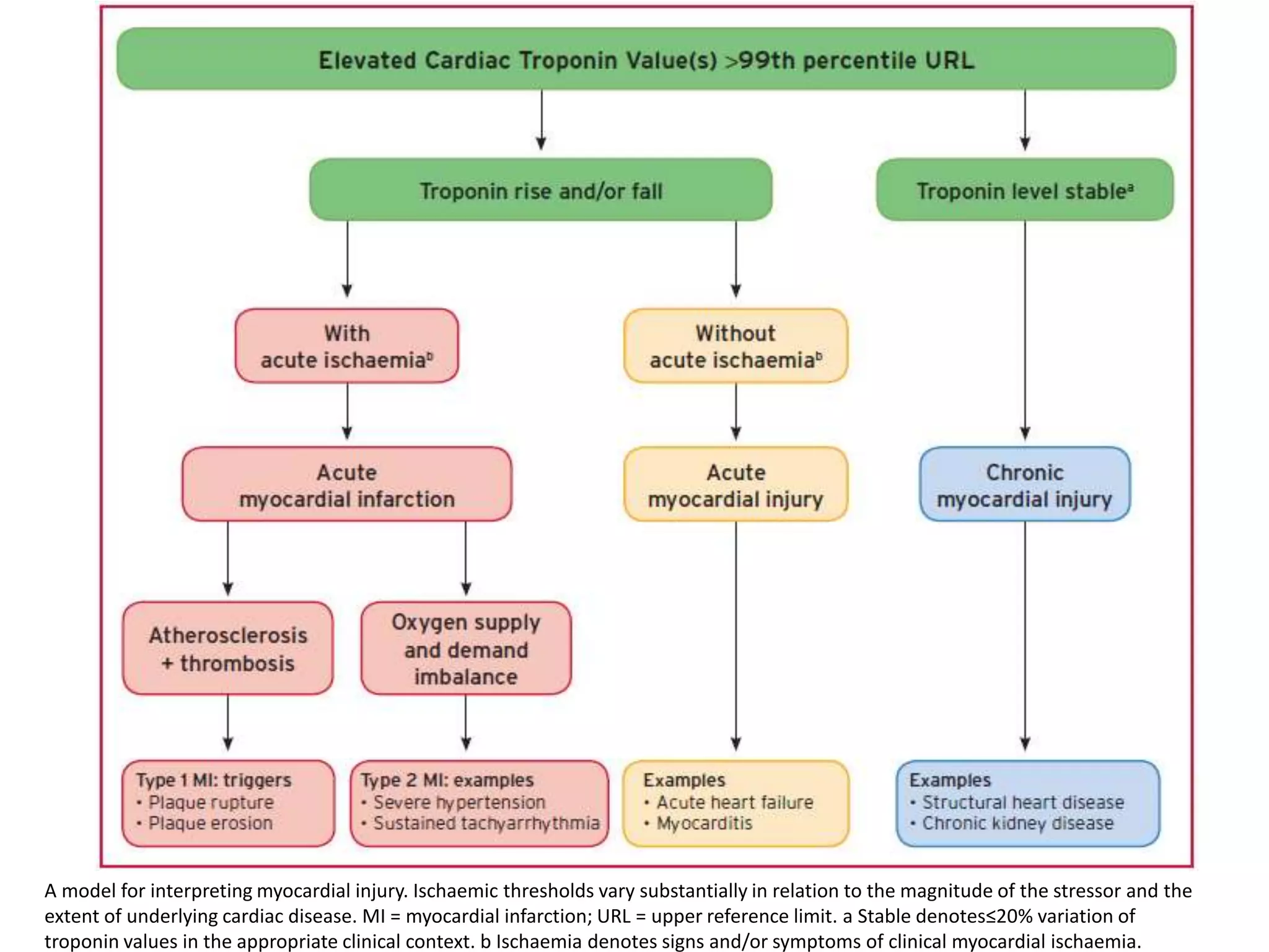 Fourth Universal Definition Of Myocardial Infarction (2018) | PPTX
