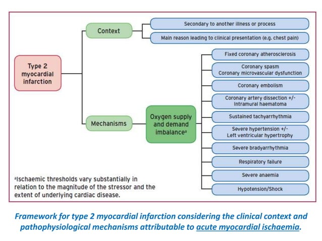 Fourth Universal Definition Of Myocardial Infarction (2018) | PPTX Fourth Universal Definition Of Myocardial Infarction (2018) | PPTX