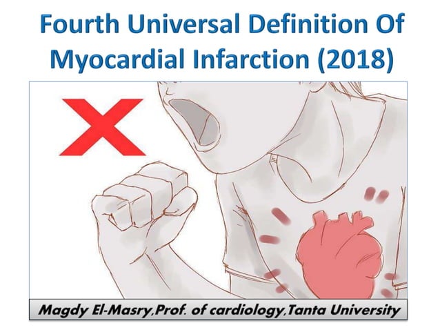 Fourth Universal Definition Of Myocardial Infarction (2018) | PPTX