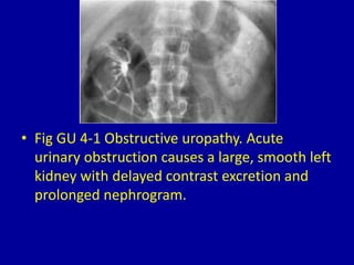 4 unilateral large, smooth kidney | PPTX