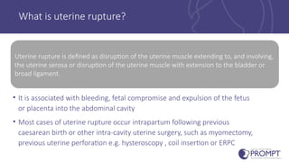 Management of Uterine rupture, obstetric Emergency.pptx