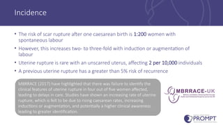 Management of Uterine rupture, obstetric Emergency.pptx
