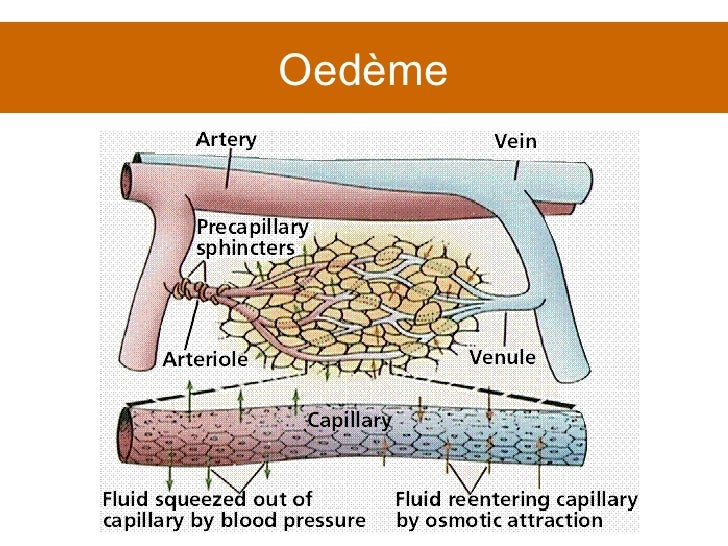 Cours 4 - Pathologie vasculaire