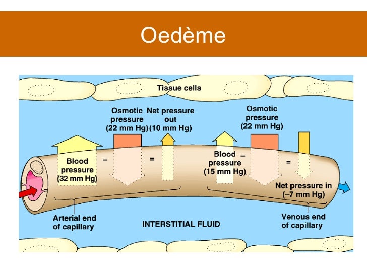Cours 4 - Pathologie vasculaire