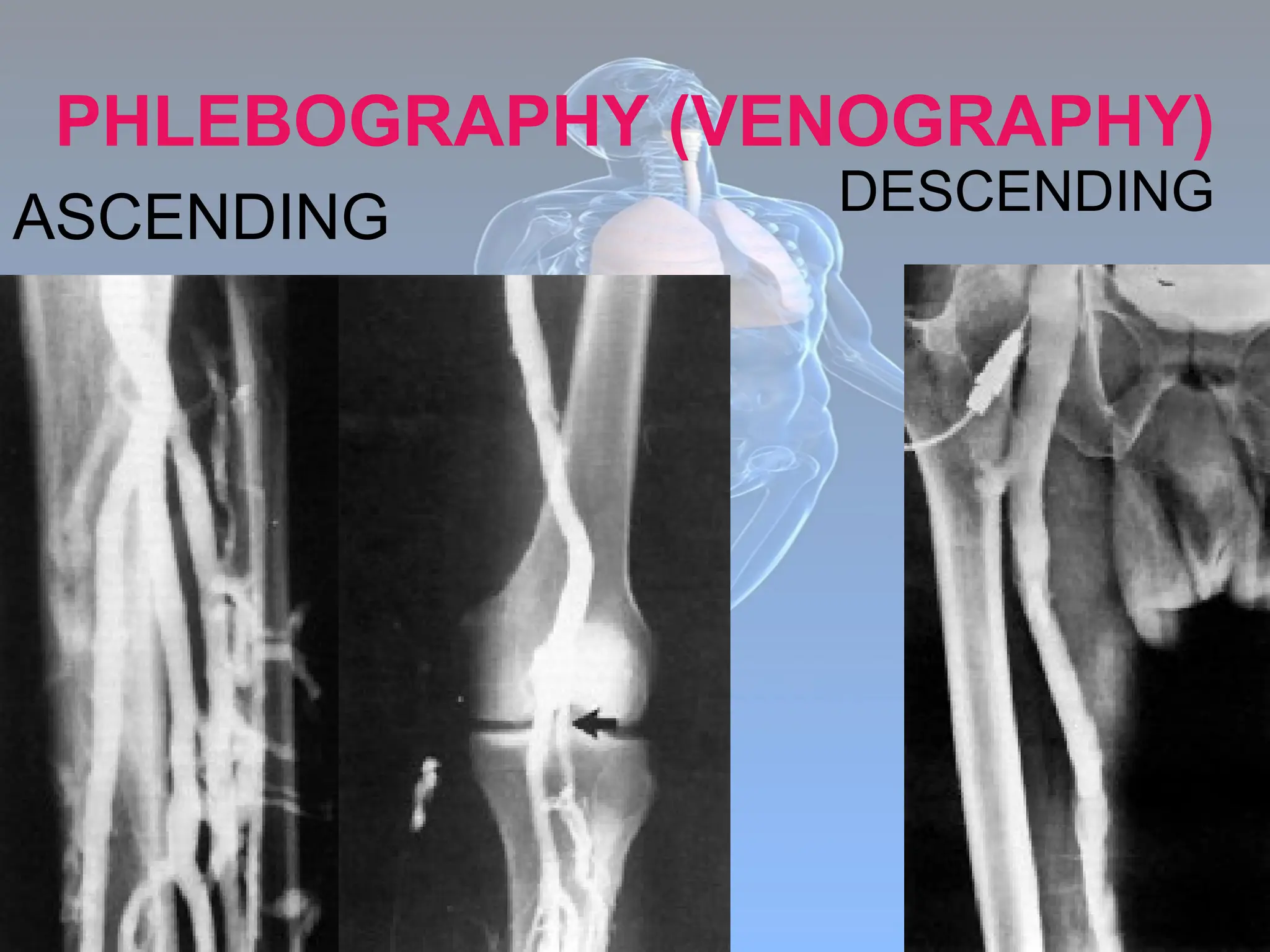 Vascular radiology blood vessels x ray CT MRI .pptx