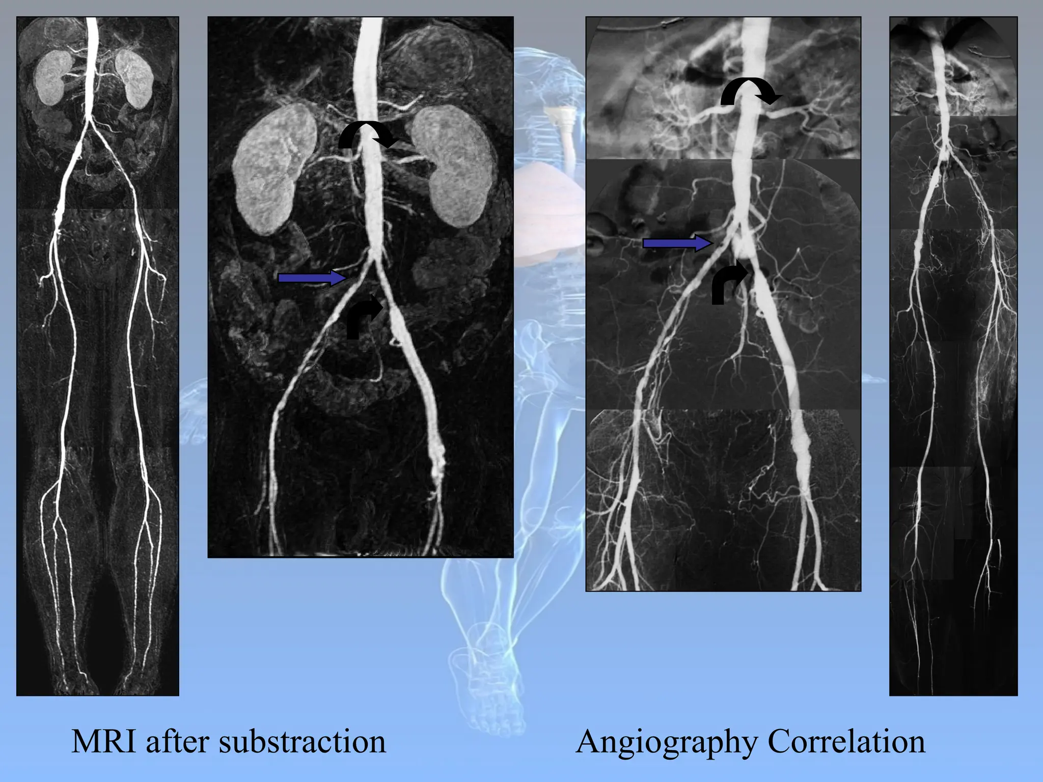 Vascular radiology blood vessels x ray CT MRI .pptx