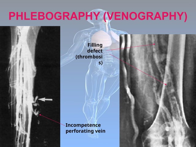 Vascular radiology blood vessels x ray CT MRI .pptx