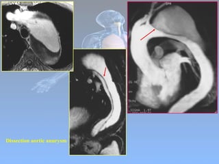 Vascular radiology blood vessels x ray CT MRI .pptx