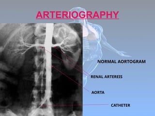 Vascular radiology blood vessels x ray CT MRI .pptx