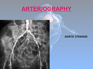 Vascular radiology blood vessels x ray CT MRI .pptx