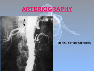 Vascular radiology blood vessels x ray CT MRI .pptx