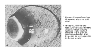 Comprehensive Overview of Vitreous Body Anatomy, Physiology, and ...