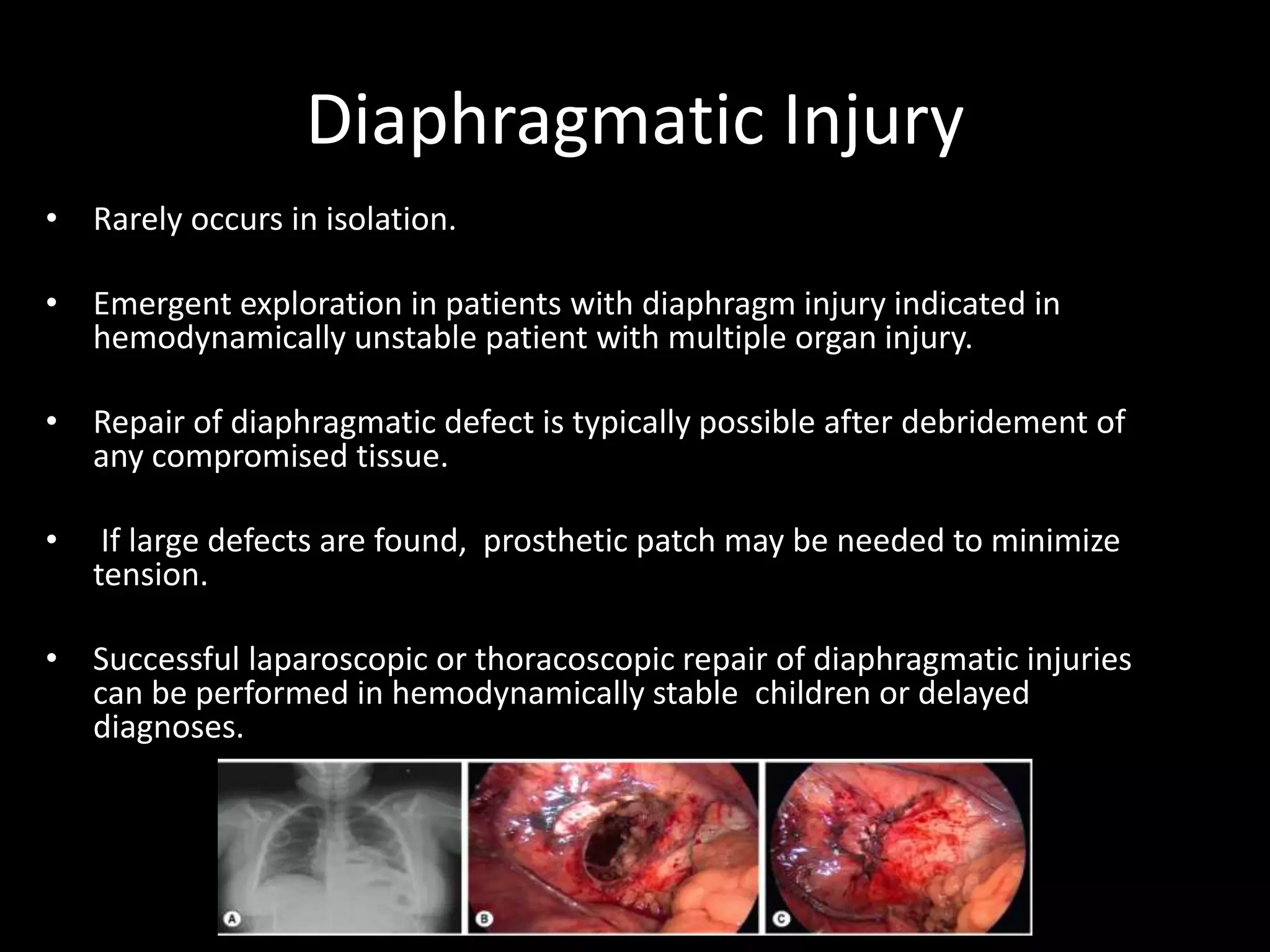 Pediatric abdominal trauma | PPTX