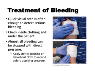 4 wfa wounds | PPT