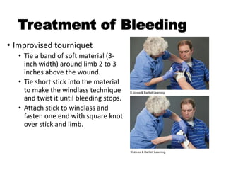 4 wfa wounds | PPT