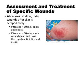 4 wfa wounds | PPT