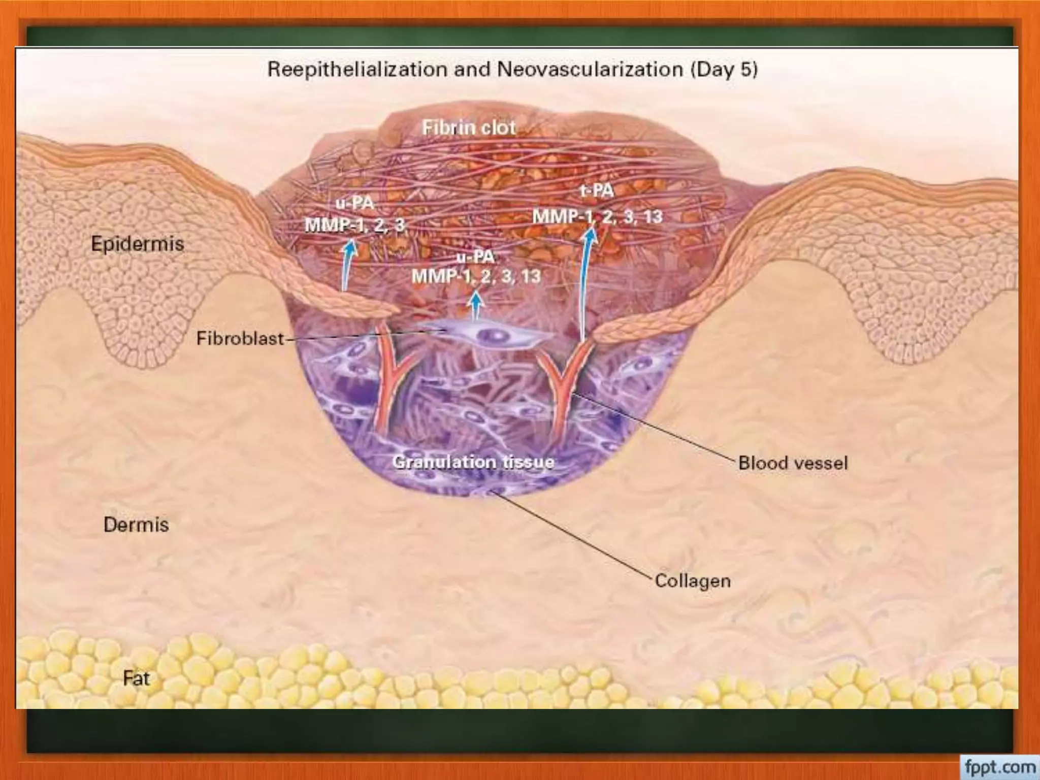 4 wound healing dr. haydar muneer salih | PPTX