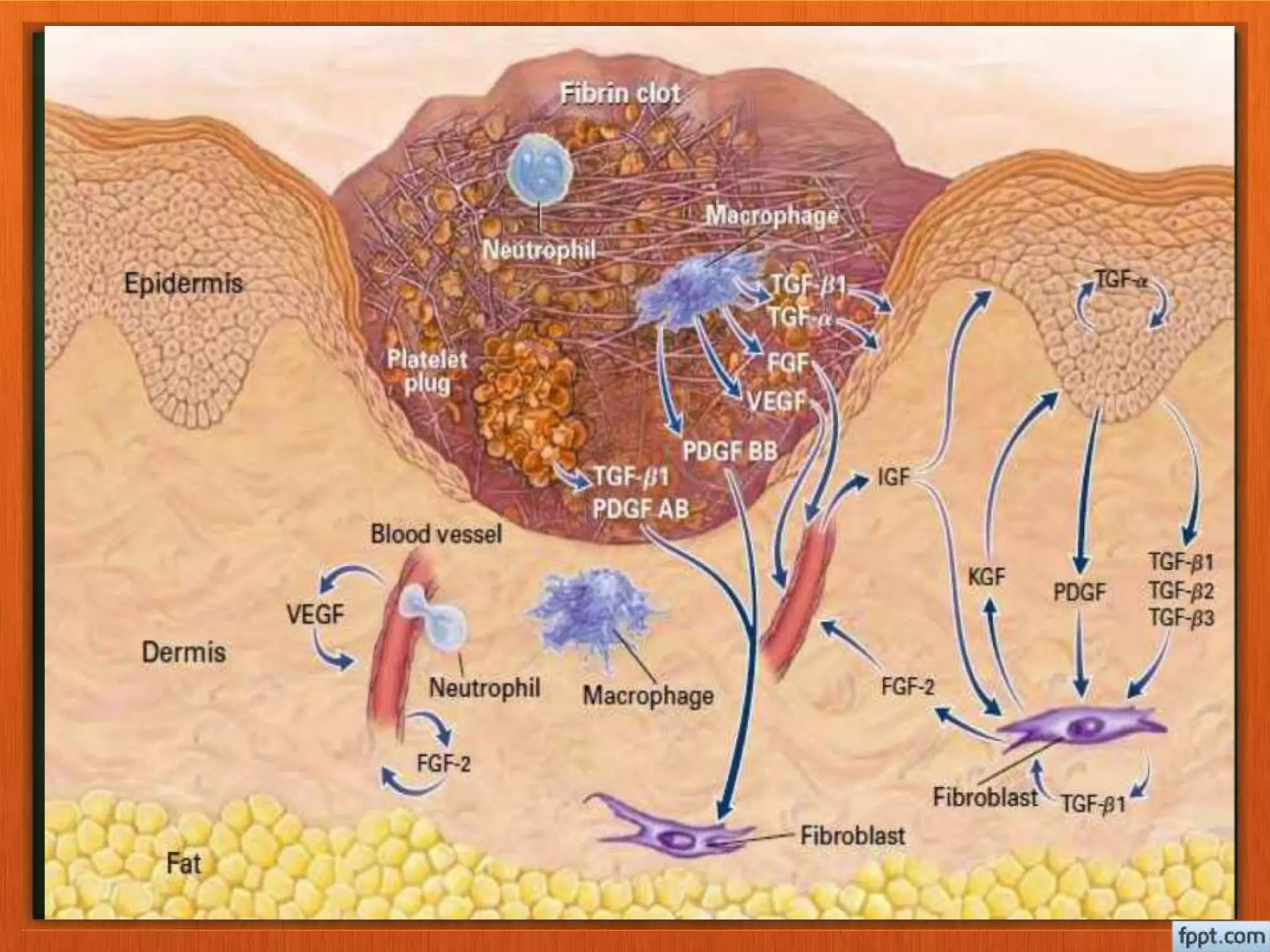 4 wound healing dr. haydar muneer salih | PPTX