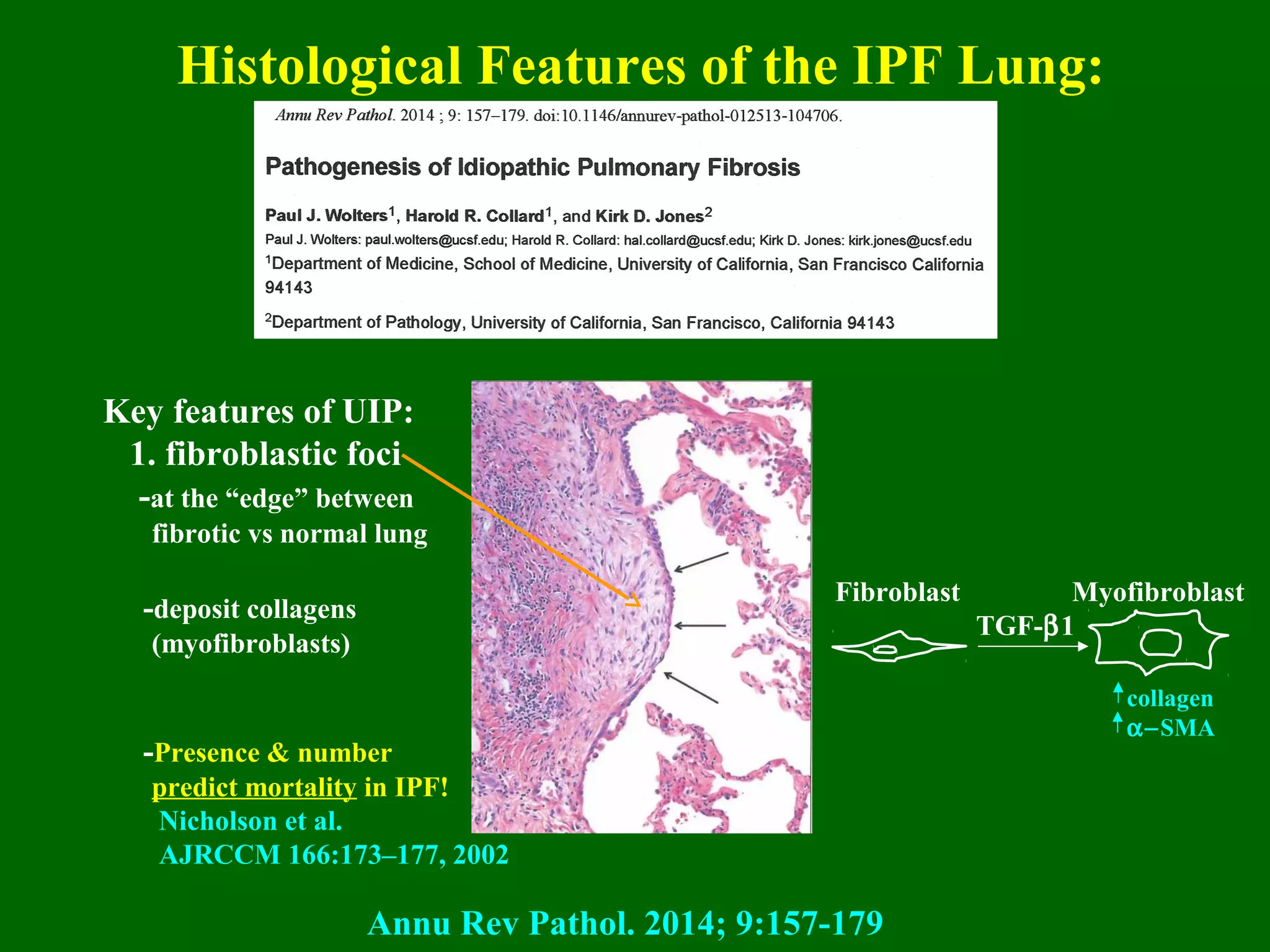 Idiopathic Pulmonary Fibrosis (IPF) | PPT