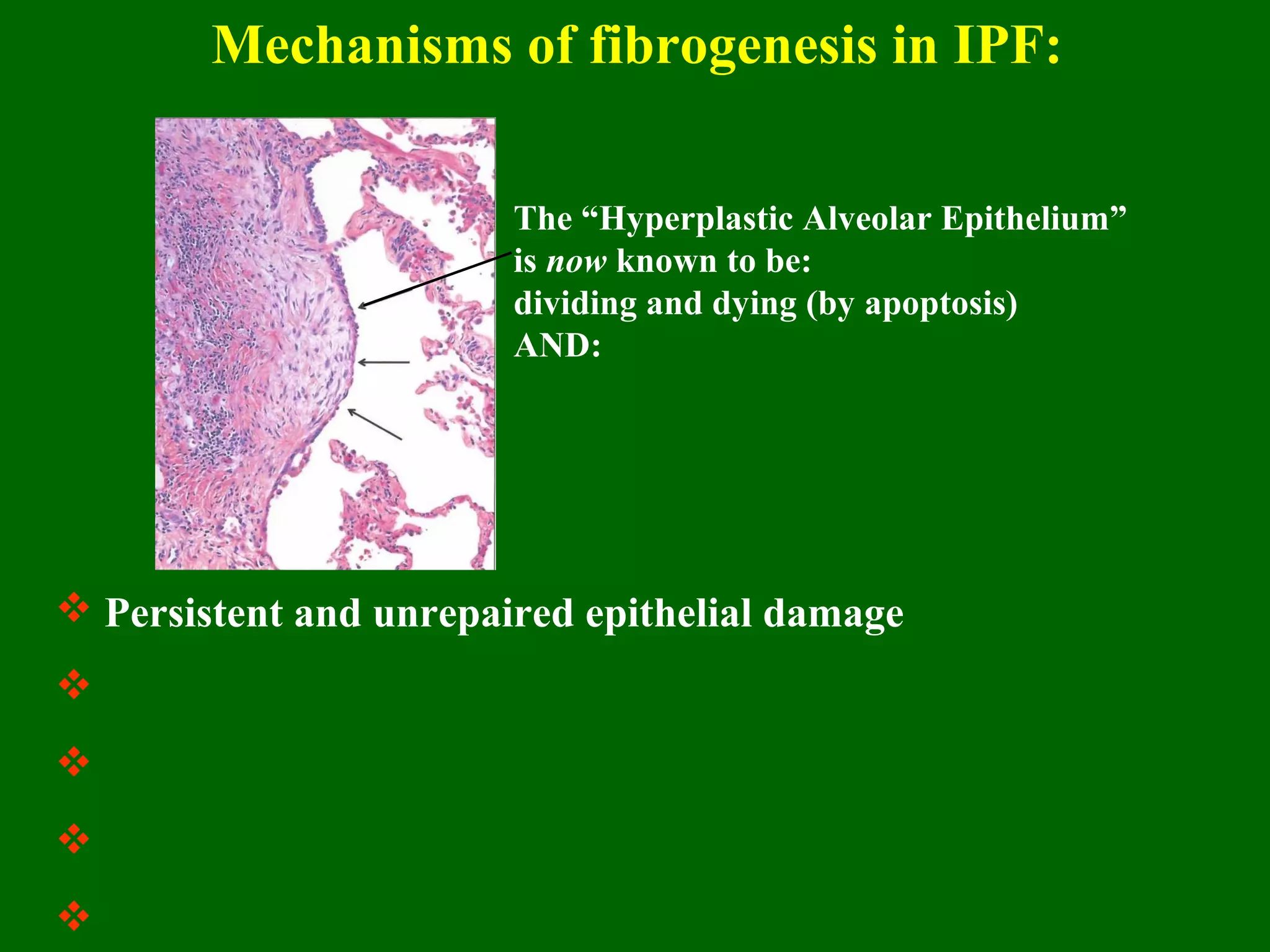 Idiopathic Pulmonary Fibrosis (IPF) | PPT