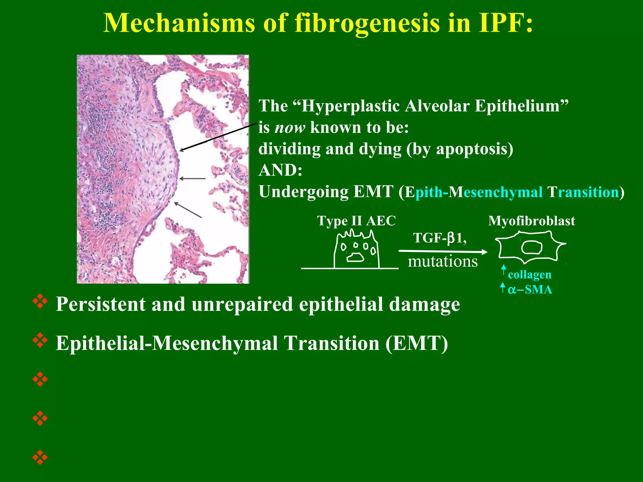 Idiopathic Pulmonary Fibrosis (IPF) | PPT