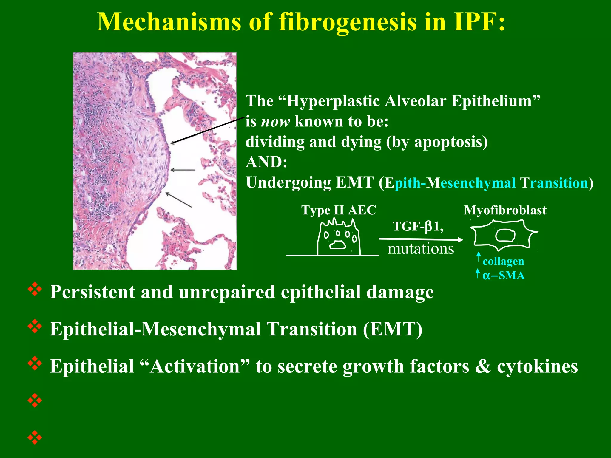 Idiopathic Pulmonary Fibrosis (IPF) | PPT