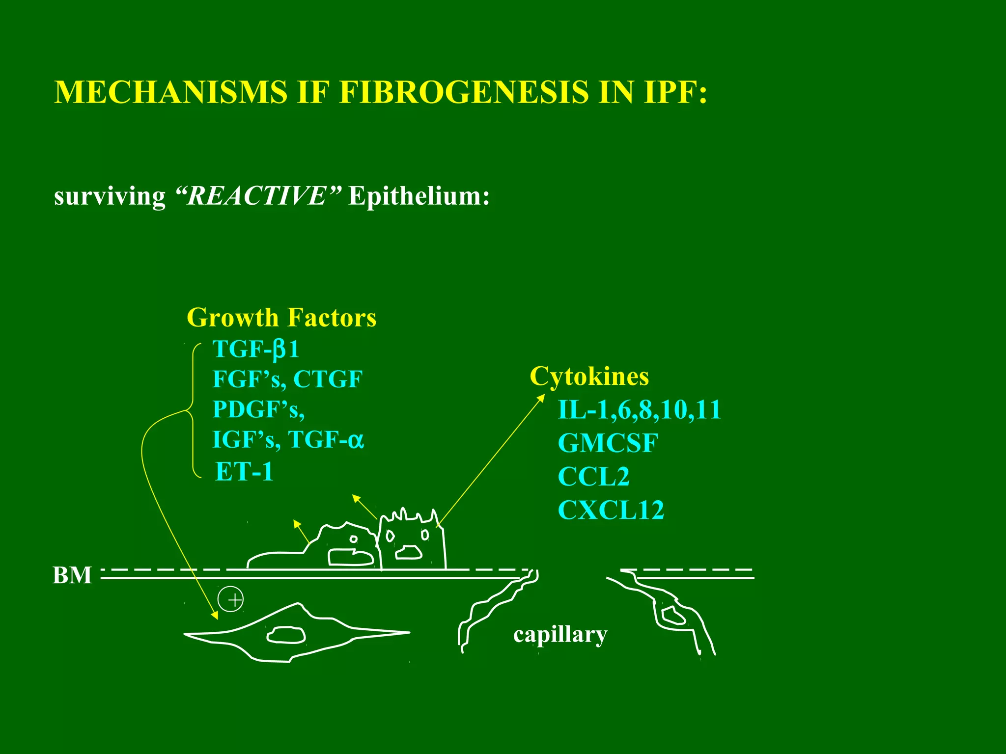 Idiopathic Pulmonary Fibrosis (IPF) | PPT