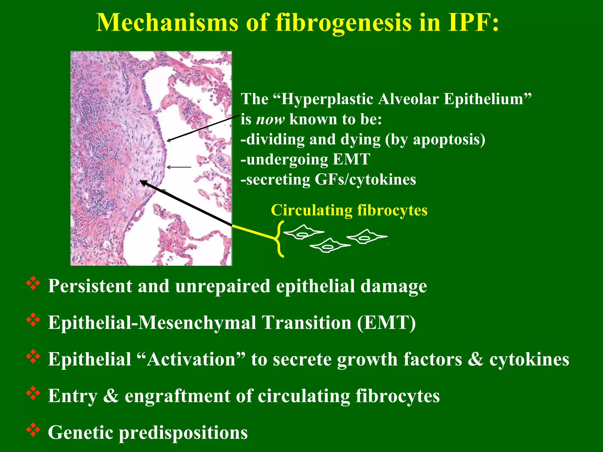Idiopathic Pulmonary Fibrosis (IPF) | PPT