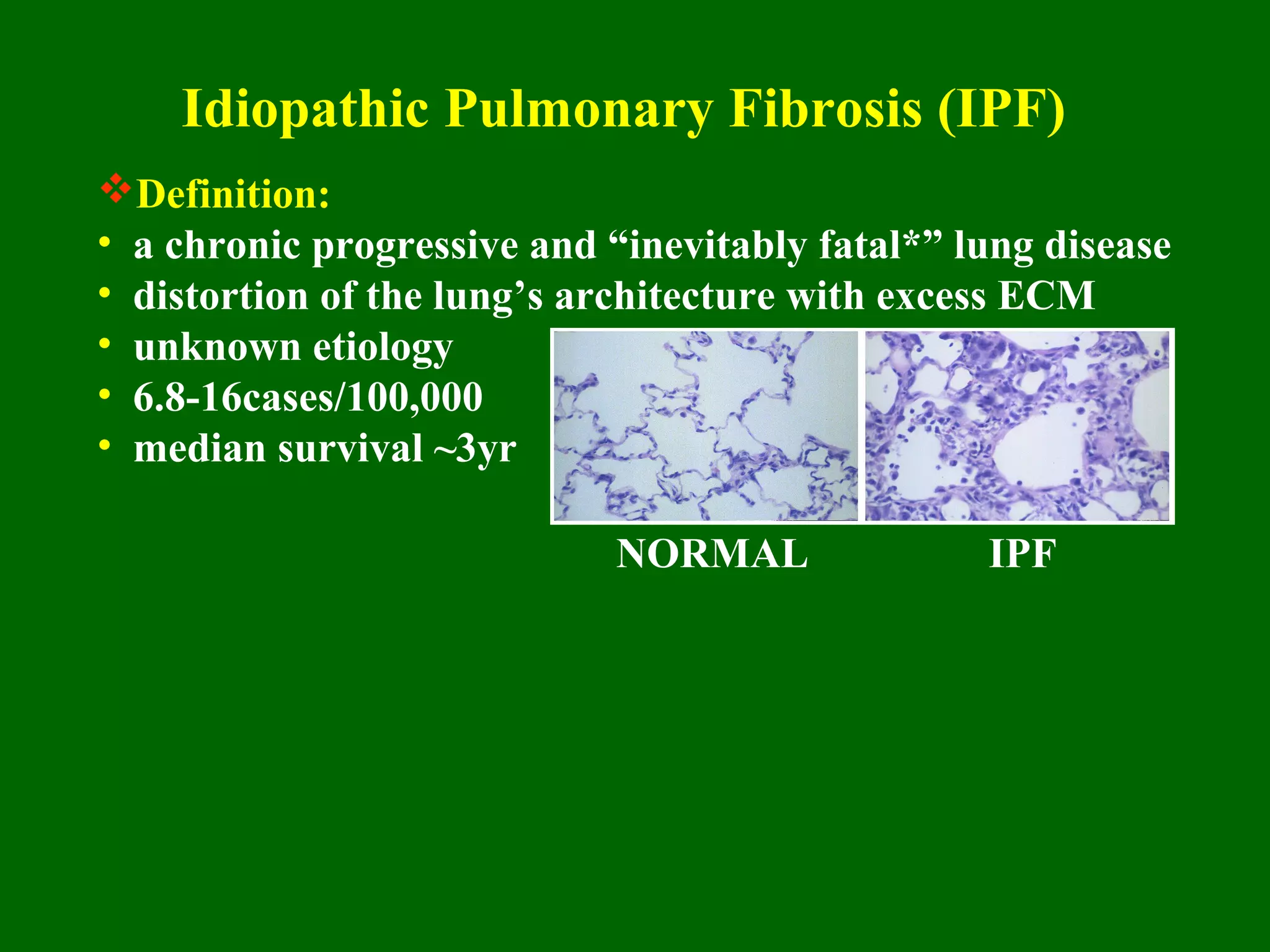 Idiopathic Pulmonary Fibrosis (IPF) | PPT