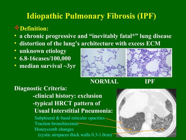 Idiopathic Pulmonary Fibrosis (IPF) | PPT | Lung and Respiratory Health ...