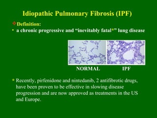 Idiopathic Pulmonary Fibrosis (IPF) | PPT