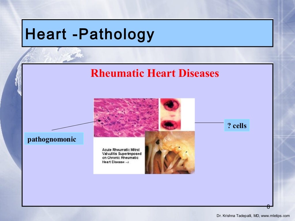 5.heart pathology; valvular heart diseases