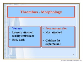 5. thrombosis; hemodynamic disorders | PPT