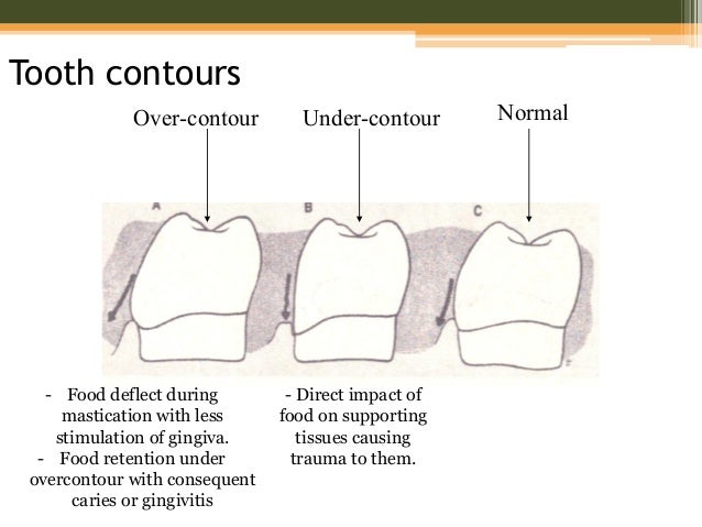 tooth form and occlusion