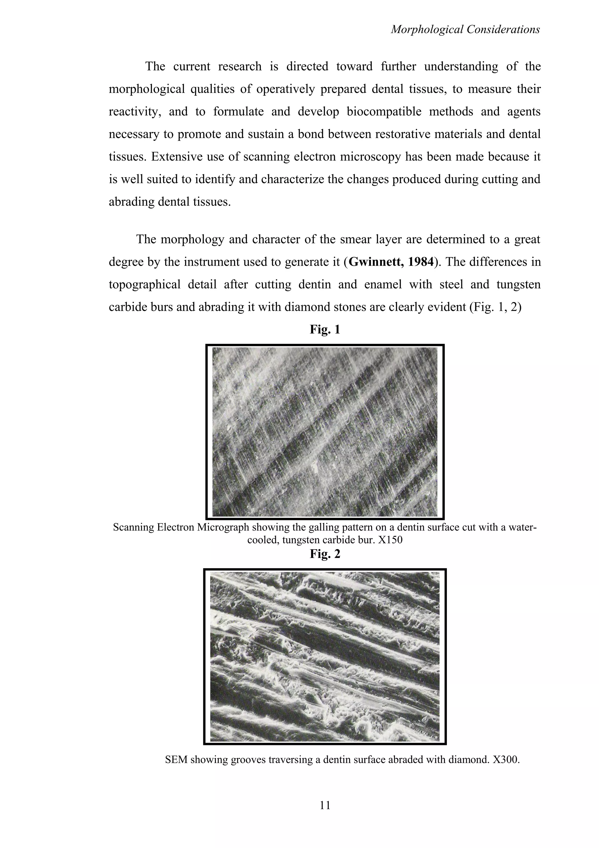morphology of smear layer/rotary endodontic courses by indian dental ...