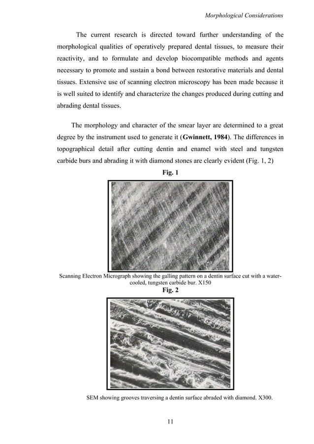 morphology of smear layer/rotary endodontic courses by indian dental ...
