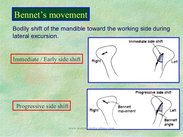 Articulators / fixed orthodontic courses