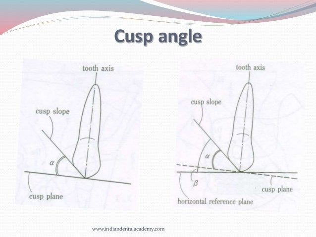 Full mouth rehabilitation/ Labial orthodontics