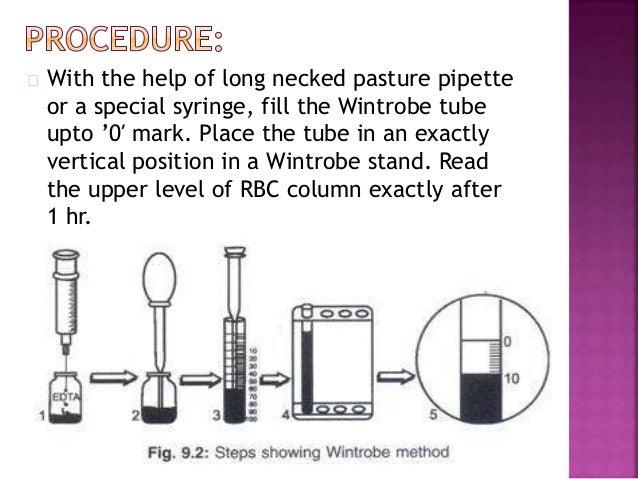 😍 Wintrobe method. Instruments used in pathology. 2019-02-04