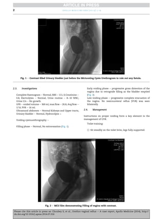 Urethro vaginal reflux – A case report | PDF