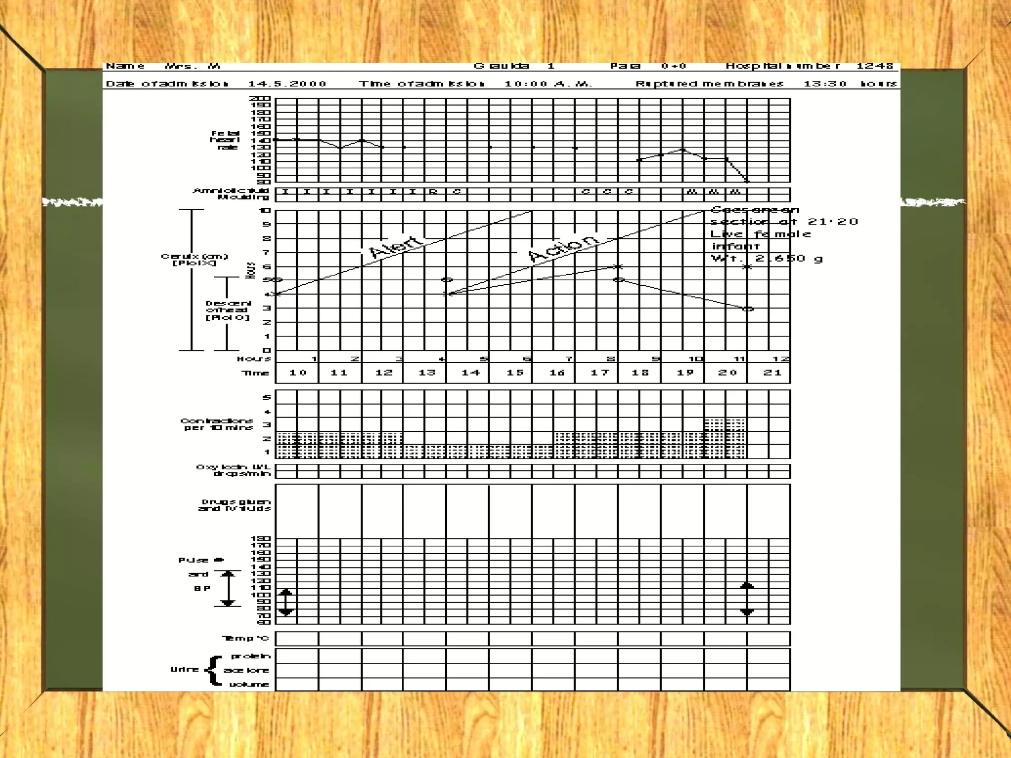 Format partograf | PPT
