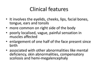 5.facial hemihypertrophy | PPTX