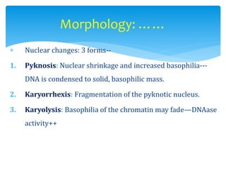5. necrosis mdzah- sp sinhasan | PPT